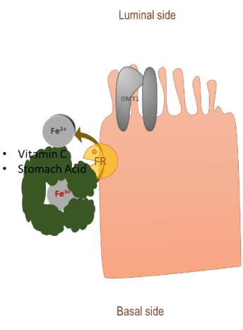 Iron deficiency anemia