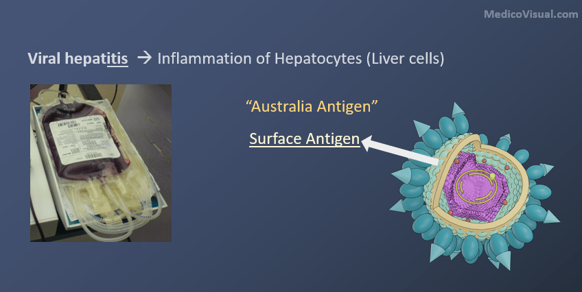 Structure of Hepatitis B Virus