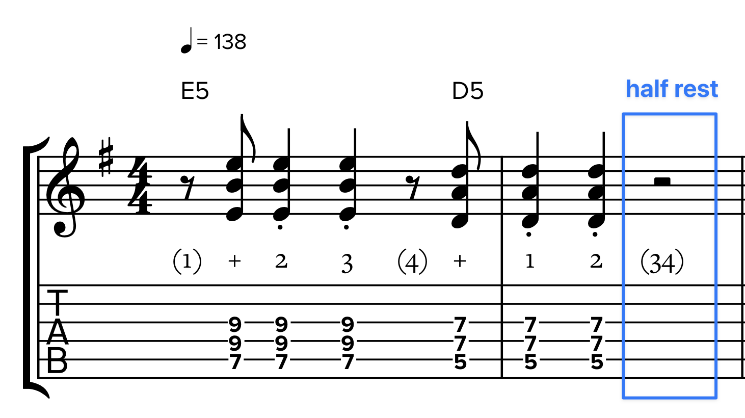 Making Theory Practical - Rhythm 1-5: Rests - Fretboard Anatomy