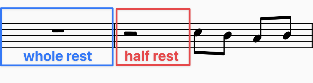 Making Theory Practical - Rhythm 1-5: Rests - Fretboard Anatomy