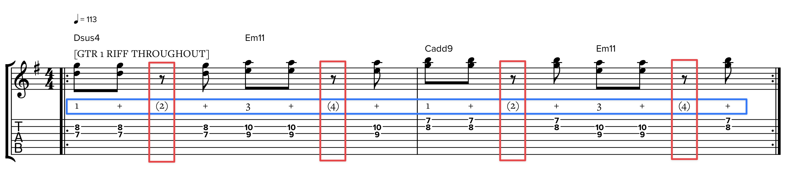 Making Theory Practical - Rhythm 1-5: Rests - Fretboard Anatomy