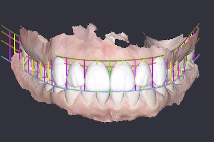 Smile Designer Online Course (instant access) | SmileFy Academy