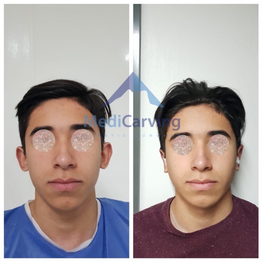 Dr. Rafael Velázquez Razo Cirujano plástico, Guadalajara - Agenda cita ...