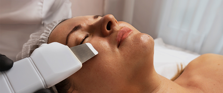 Peeling ultrassônico: veja do que este procedimento estético é capaz