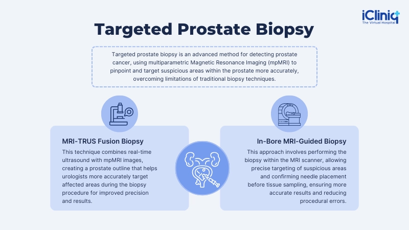 What Is Targeted Prostate Biopsy?